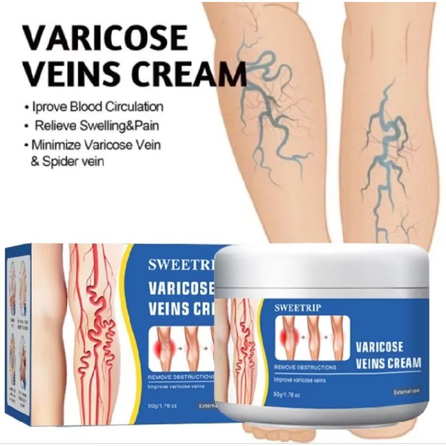 Jual CLARIVEN CREAM - Krim Varises Jepang Handal, Lenyapkan Varises ...