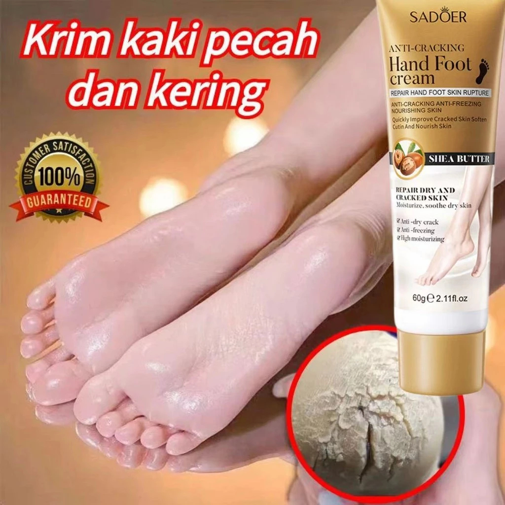 Jual [COD, Pengiriman dalam 12 Jam] [BPOM] ORI 100% SADOER Krim Kaki ...