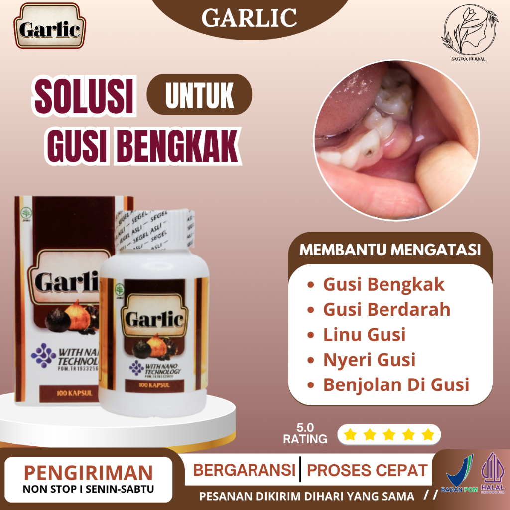 Jual Obat Gusi Bengkak Gusi Berdarah Linu Gusi Nyeri Gusi Benjolan Di ...