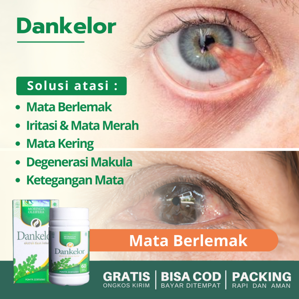 Jual DANKELOR Obat Mata Berlemak Kekuningan, Penyakit Pterigium ...