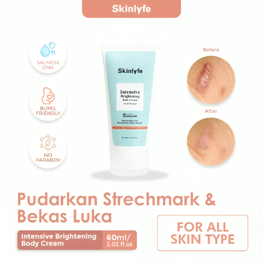 Jual Skinlyfe Penghilang Bekas Luka Strechmark Ibu Hamil Cream ...