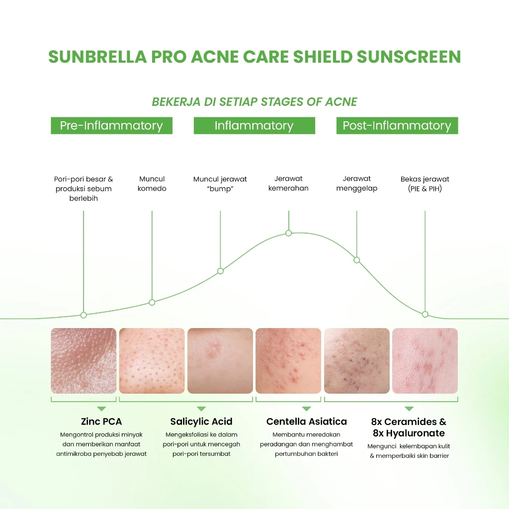 Jual YOU Sunbrella PRO Acnecare Shield Sunscreen 30ml | Shopee Indonesia