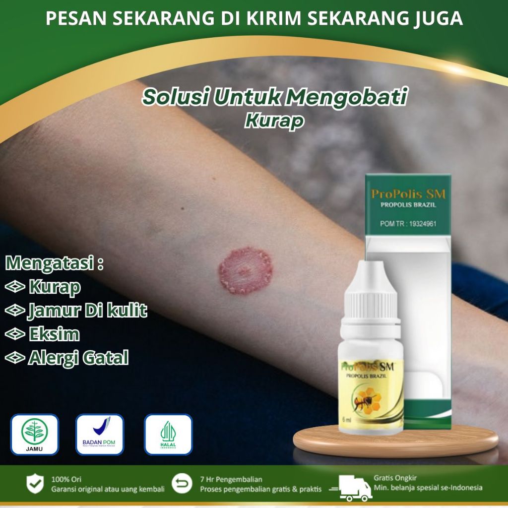 Jual Propolis Sm - Obat Gatal Kulit Kurap, Kulit Eksim Basah/Kering ...