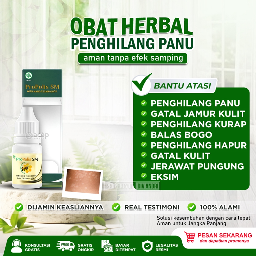 Jual Panu Obat Panu Cair Di Wajah Anak Dan Dewasa Penghilang Panu Di ...