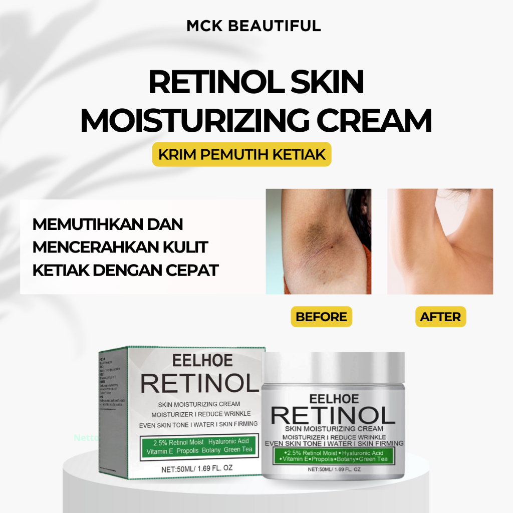 Jual Eelhoe Retinol Cream Krim Pemutih Badan Ampuh Untuk Ketiak dan ...