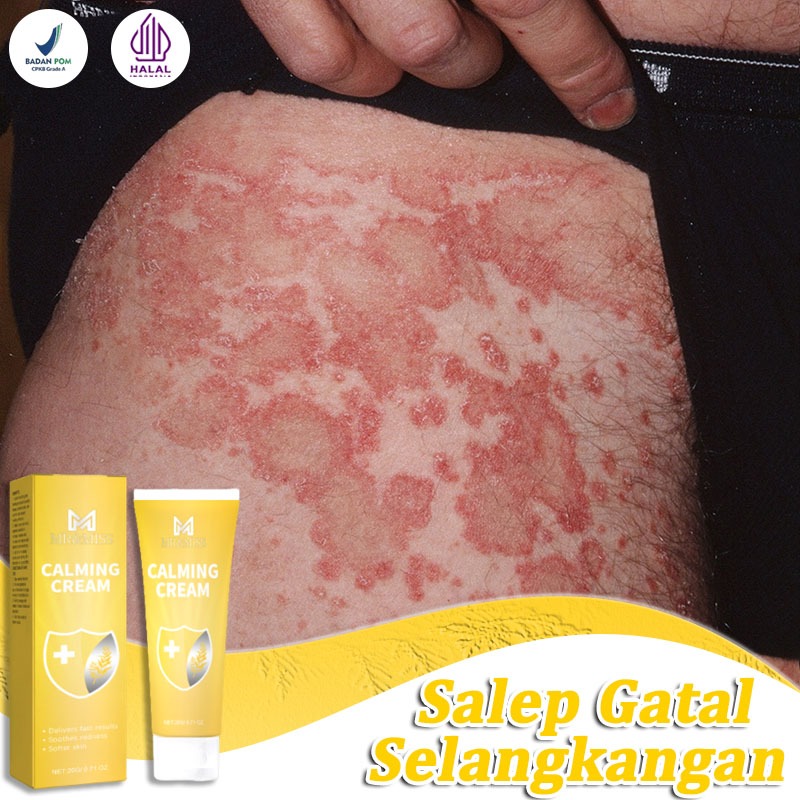 Jual Obat gatal selangkangan obat eksim obat kurap salep gatal 20ml ...