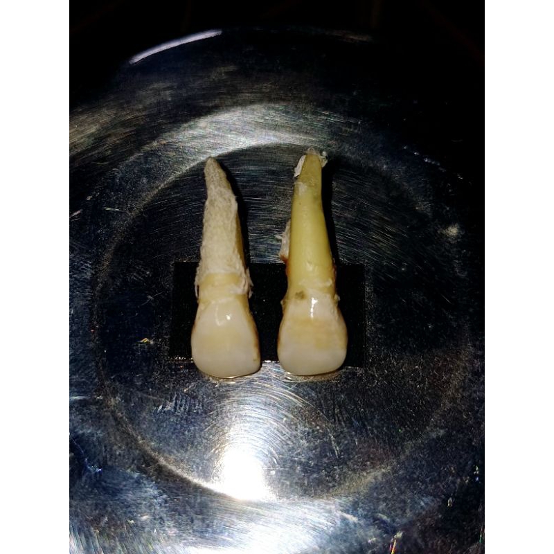 Jual Gigi incisivus 2 kiri dan kanan atas, untuk praktikum kedokteran ...