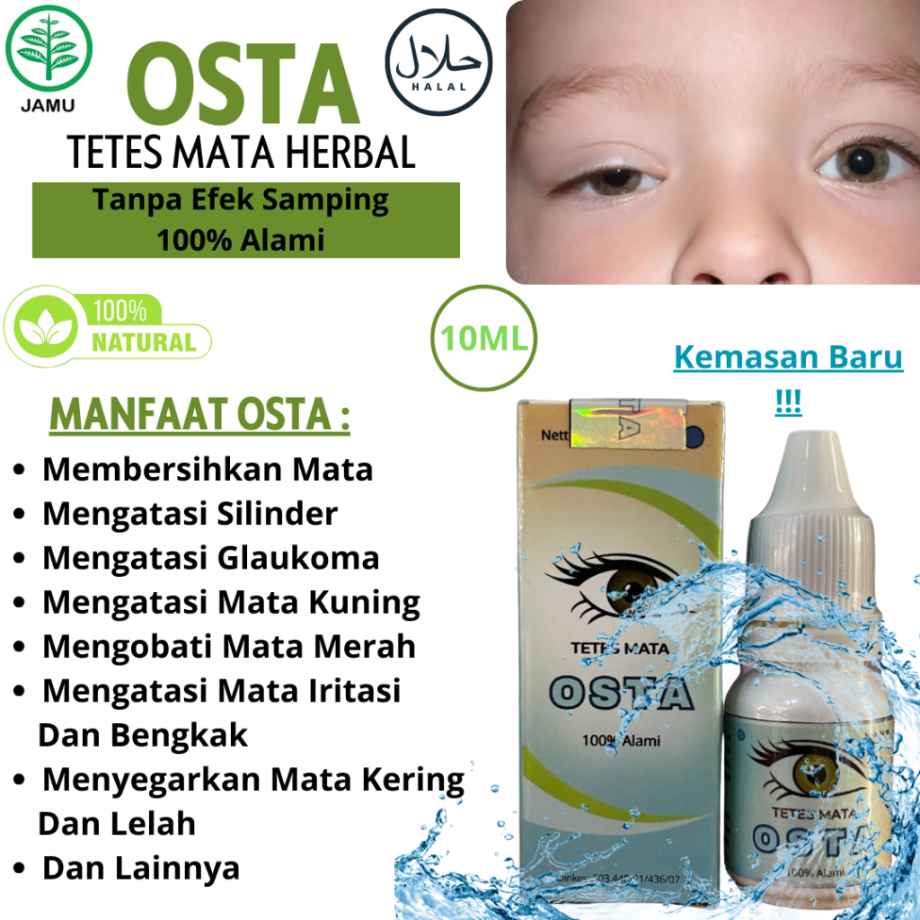 Jual Kelopak Mata Turun, Mata Malas, Saraf Mata Rusak // Ampuh Dengan ...