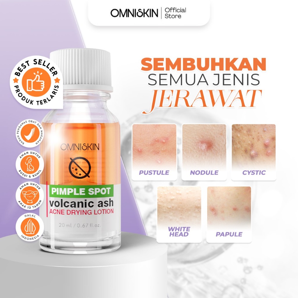 Jual Volcanic Ash Pimple Drying Lotion 20ml - Obat Totol Jerawat ...