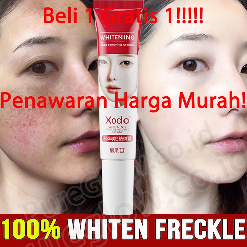 Jual （Promosi Spesial!）Whitening Freckle Cream Krim Pemutih Penghilang Bintik Wajah Krim Salep ...
