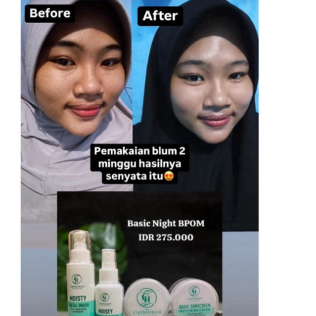 Jual chumairah skincare paket basic BPOM | Shopee Indonesia