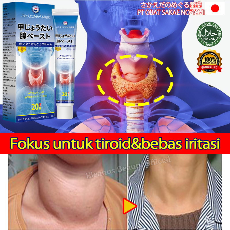 Jual Obat tiroid Obat Benjolan di Leher Hipertiroid Hipotiroid Gondok ...
