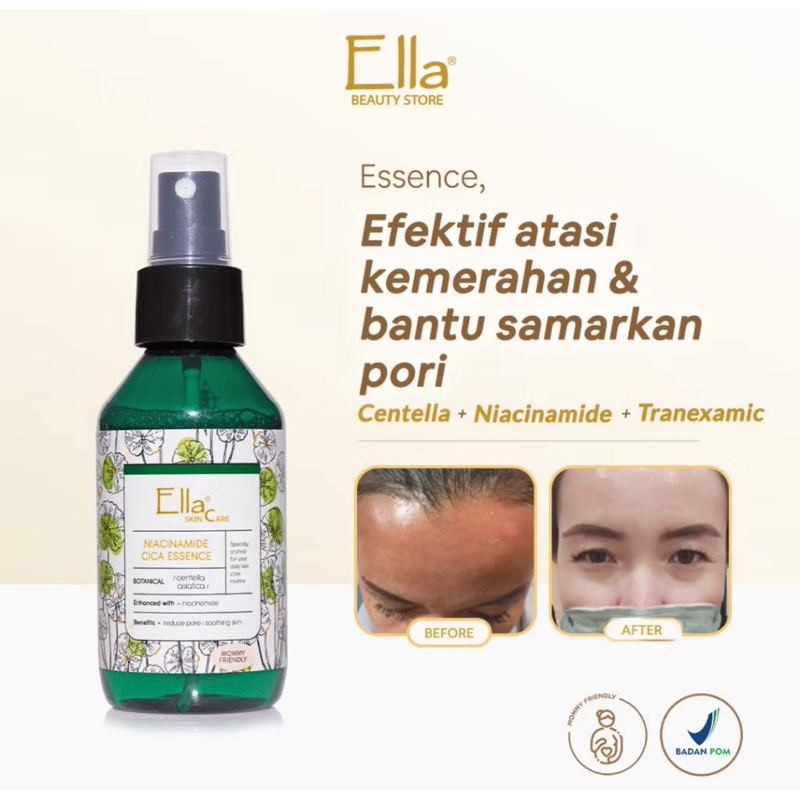 Jual Niacinamide Cica Essence Ella Skincare | Shopee Indonesia