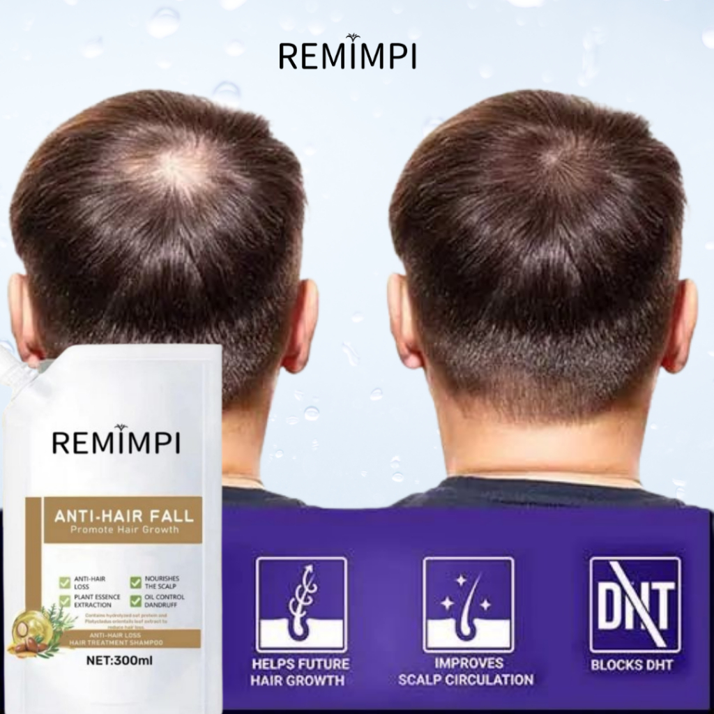 Jual [Remimpi Official] Anti Hair Fall Hair Treatment Shampoo Rambut ...