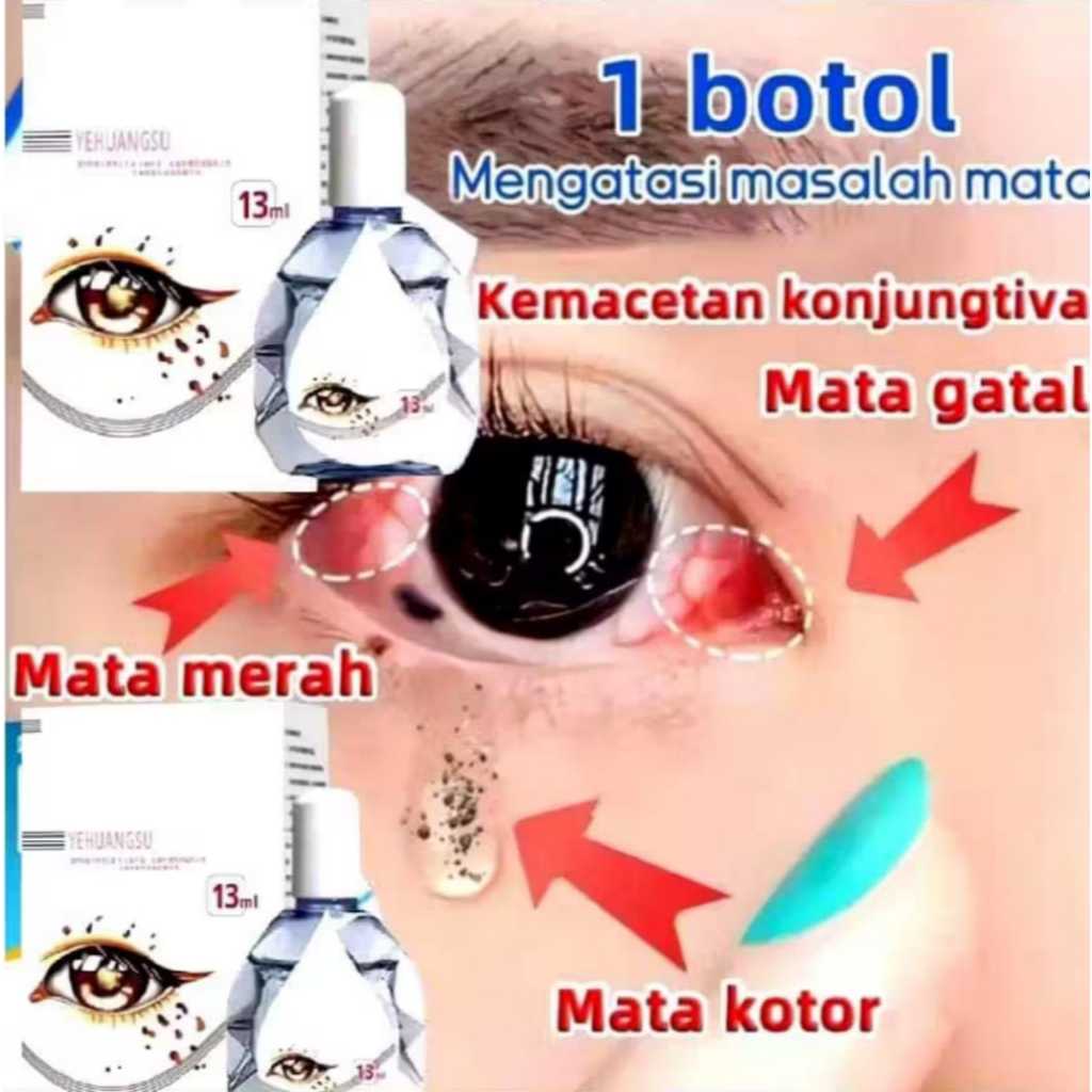 Jual [Ampuh] Obat Tetes Mata Berlemak Kekuningan Penyakit Pterigium ...