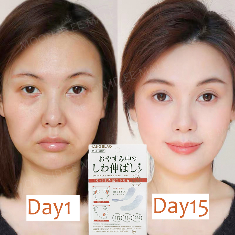 Jual Sticker wajah anti kerut selotip Pengencang kulit wajah ...