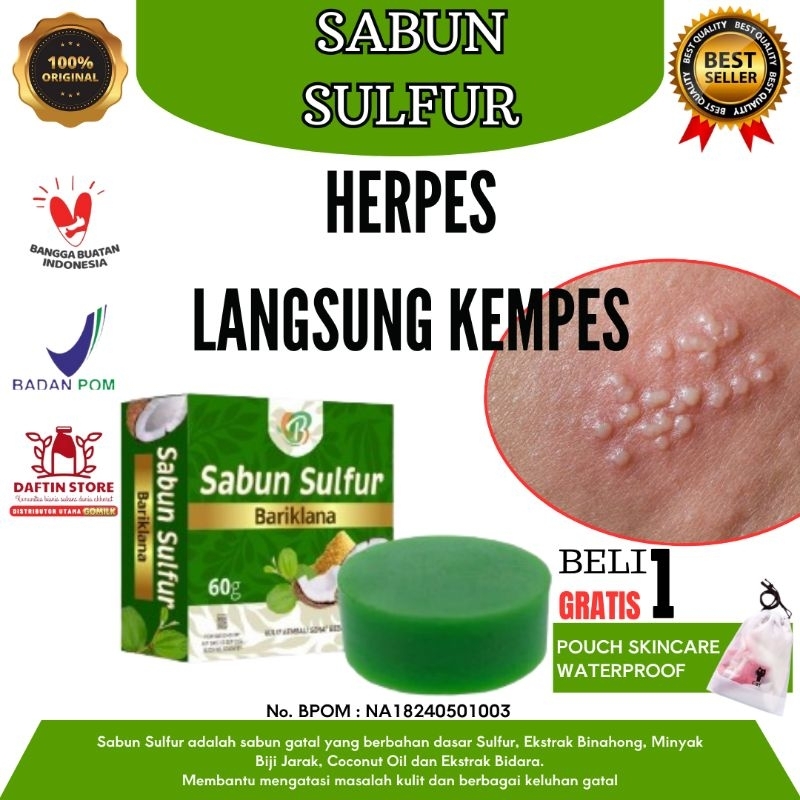 Jual [FREE HADIAH] SABUN SULFUR MENGATASI GATAL HERPES KURAP KUDIS ...