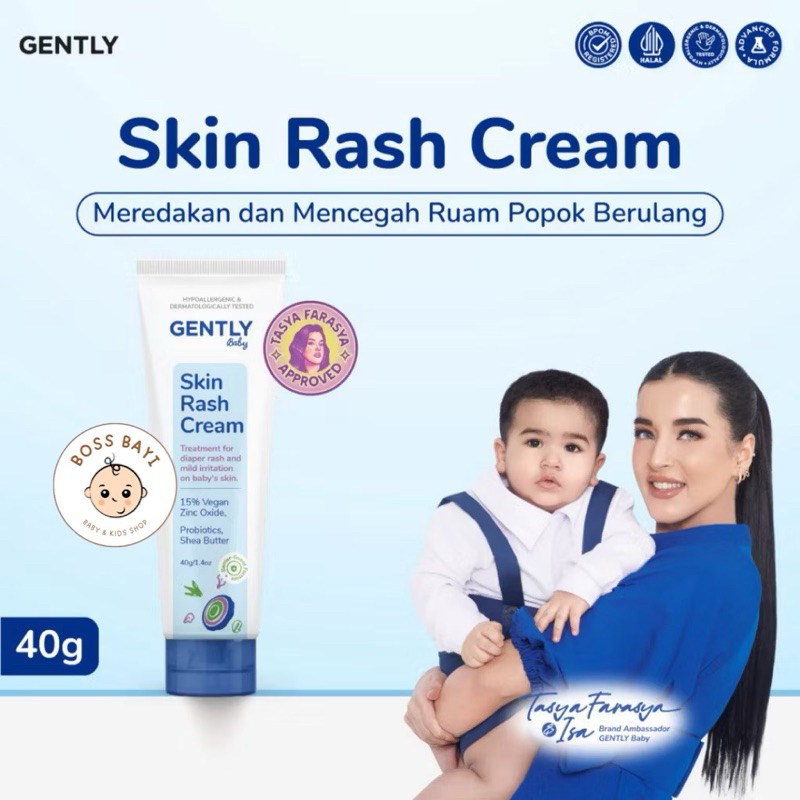 Jual GENTLY - Rash Cream / Krim Ruam Popok Bayi dan Anak 50gr | Shopee ...