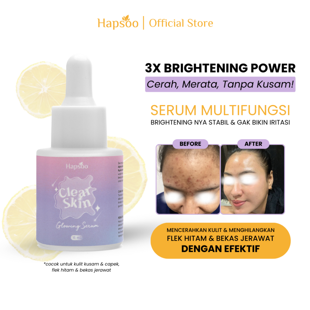 Jual Serum Bekas Jerawat Hitam Mencerahkan Wajah Glowing Dark Spot ...