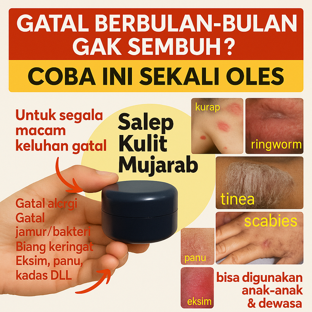 Jual Obat Gatal Kulit Ampuh – Atasi Jamur, Eksim, Kurap, Kudis, Gatal ...