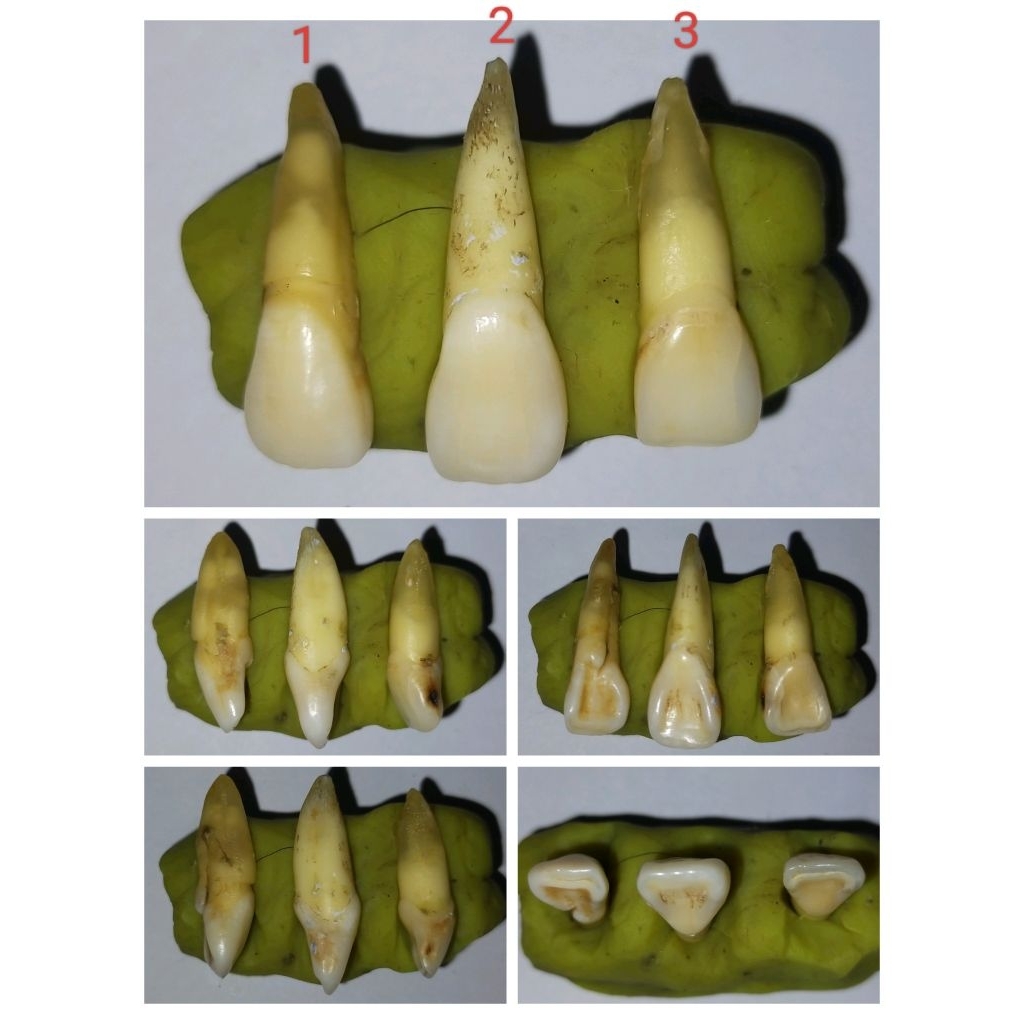 Jual Gigi insisivus rahang atas dan bawah | Shopee Indonesia