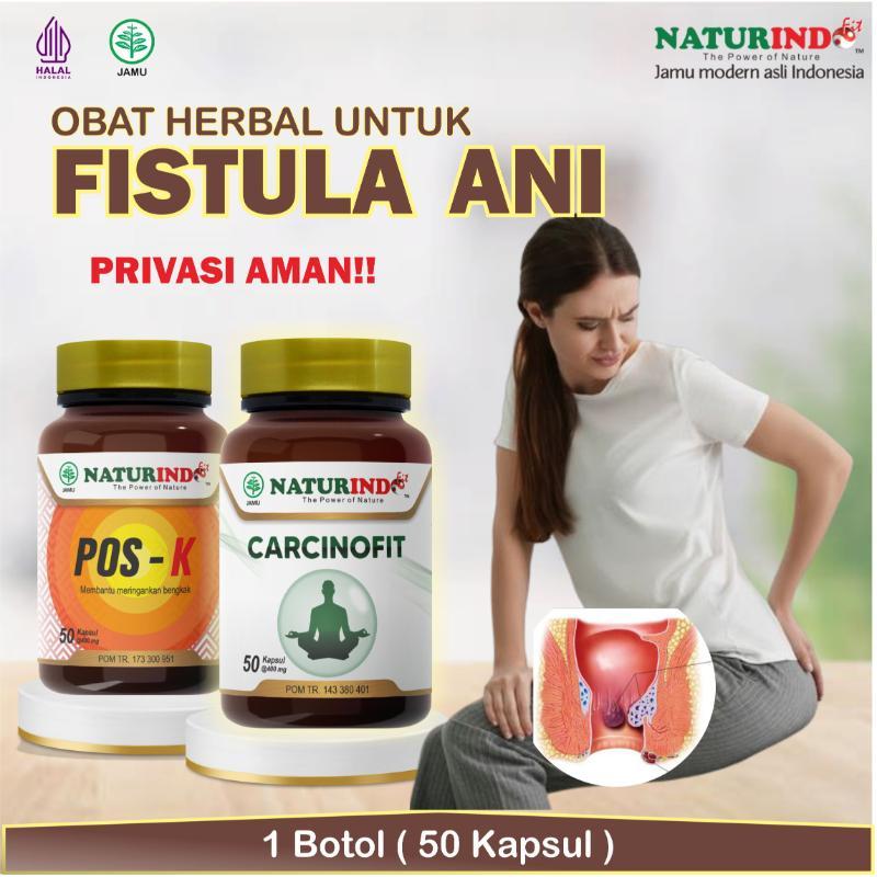 Jual Obat Fistula Ani Benjolan Dalam Dan Luar Anus Bisul Bernanah di ...