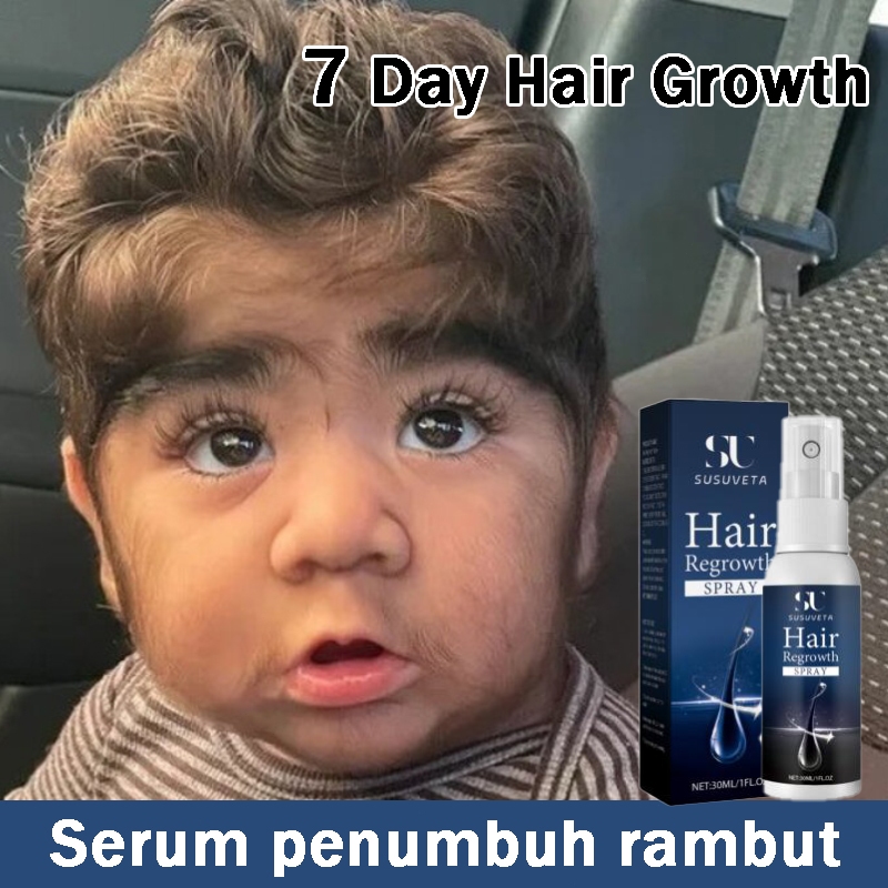 Jual SUSUVETA Serum penumbuh rambut Hair tonic penumbuh rambut Penumbuh ...