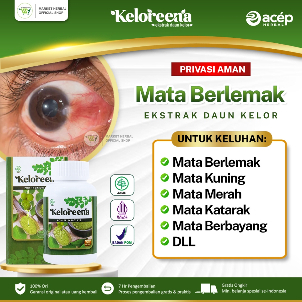 Jual Obat Mata Berlemak Ptregium Kekuningan Vitamin Untuk Mata Keloreena Ekstrak Daun kelor ...