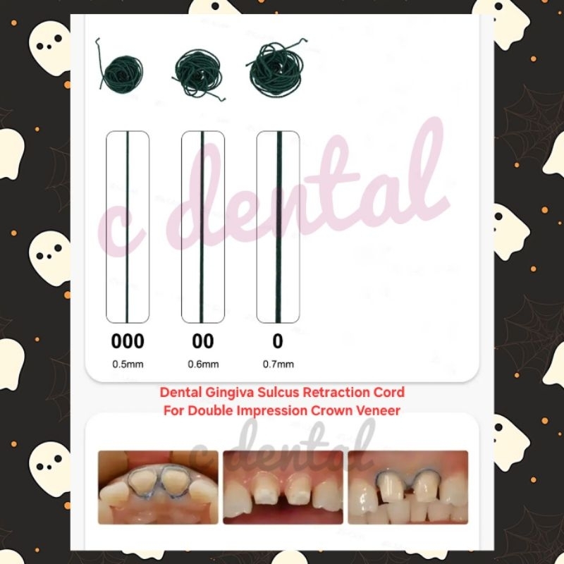Jual Dental Gingiva Sulcus Retraction Cord For Double Impression Crown ...