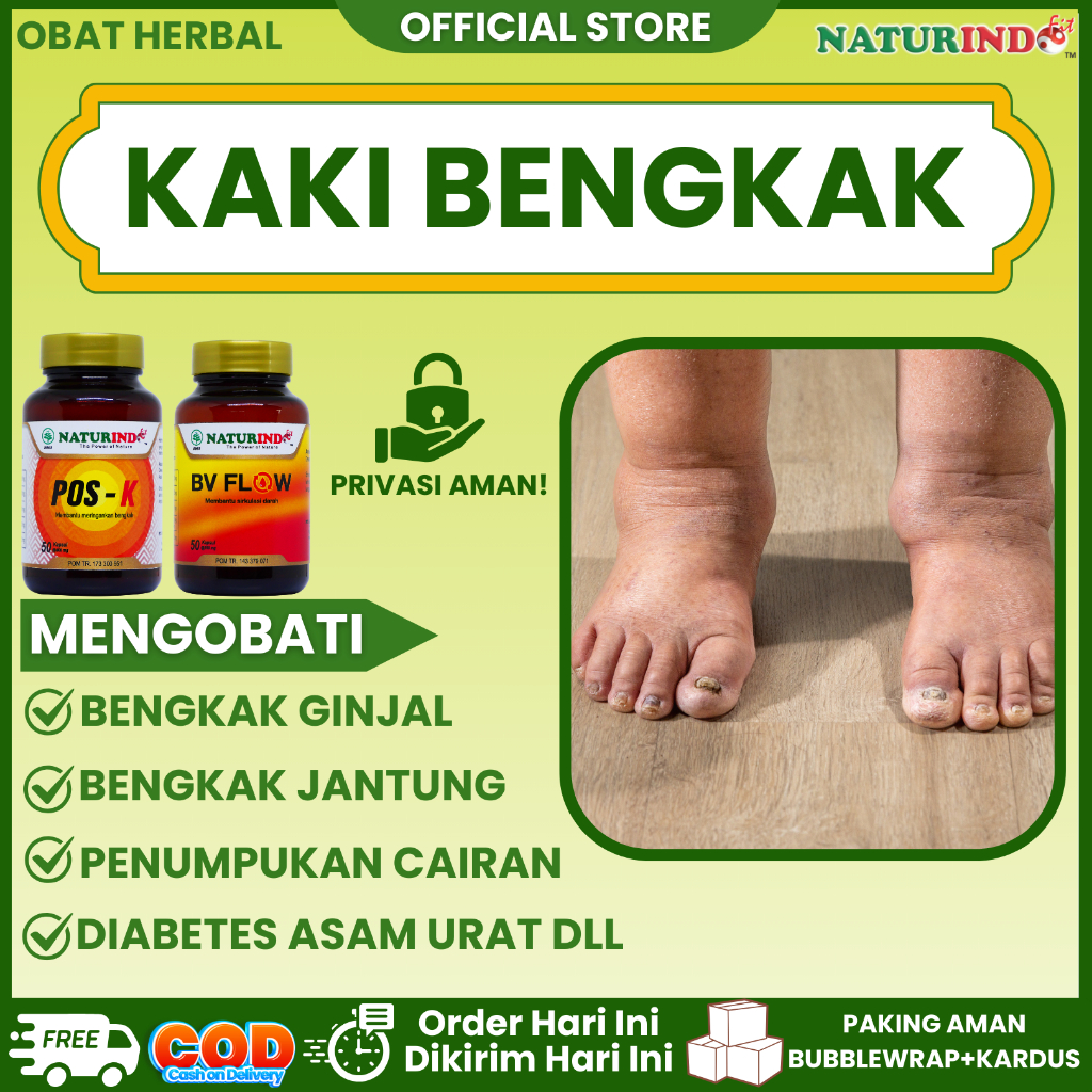 Jual Obat Kaki Bengkak Herbal Ampuh Diabetes Saraf Penyumbatan Darah ...