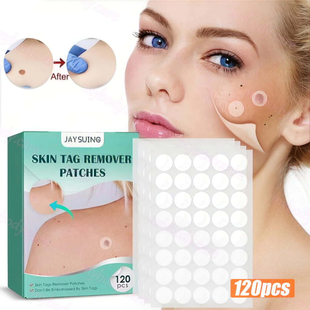 Jual Stiker Penghilang Kutil Tahi Lalat Wart Removal Patch 120PCS/Box ...
