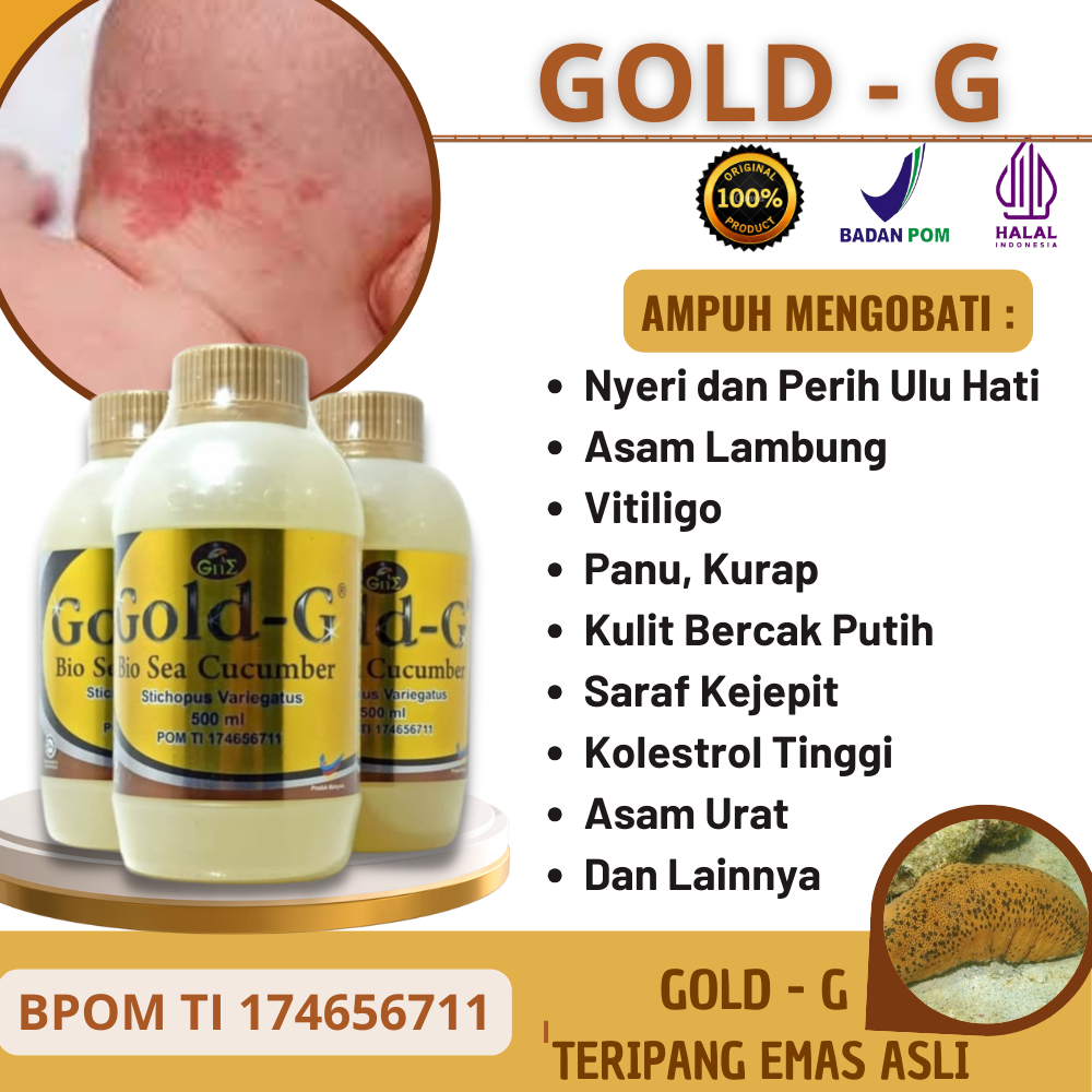 Jual Jelly Gamat GOLD-G Solusi Herbal Penghilang Tanda Lahir Merah ...