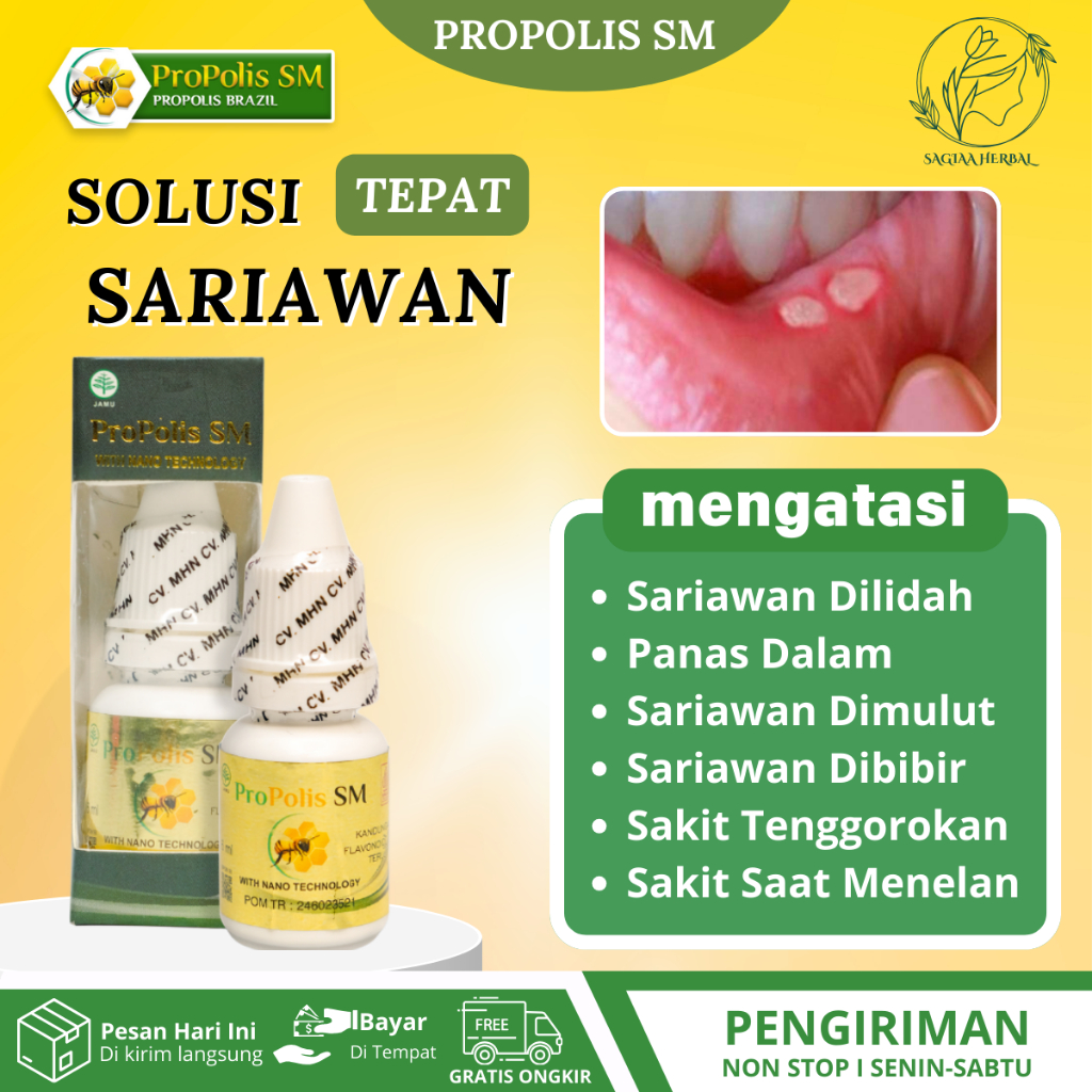 Jual Obat Sariawan Sariawan Dilidah Panas Dalam Sariawan Dimulut ...