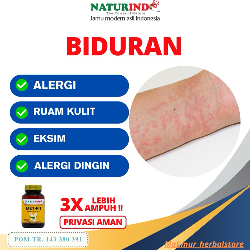 Jual OBAT HERBAL ALERGI KULIT , KULIT RUAM , BIDURAN ALERGI KULIT ...