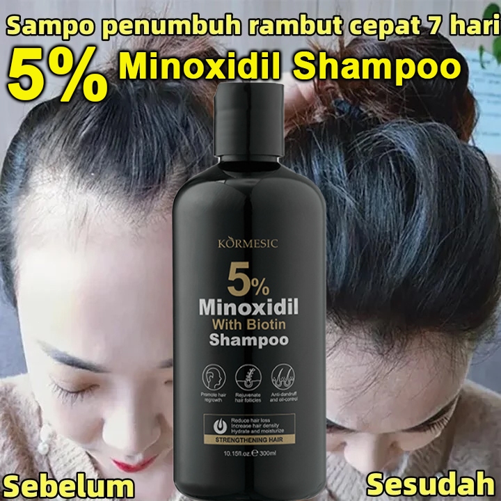 Jual Minoxidil Hair shampoo Hair Fall Treatment Shampoo Shampo Penumbuh ...