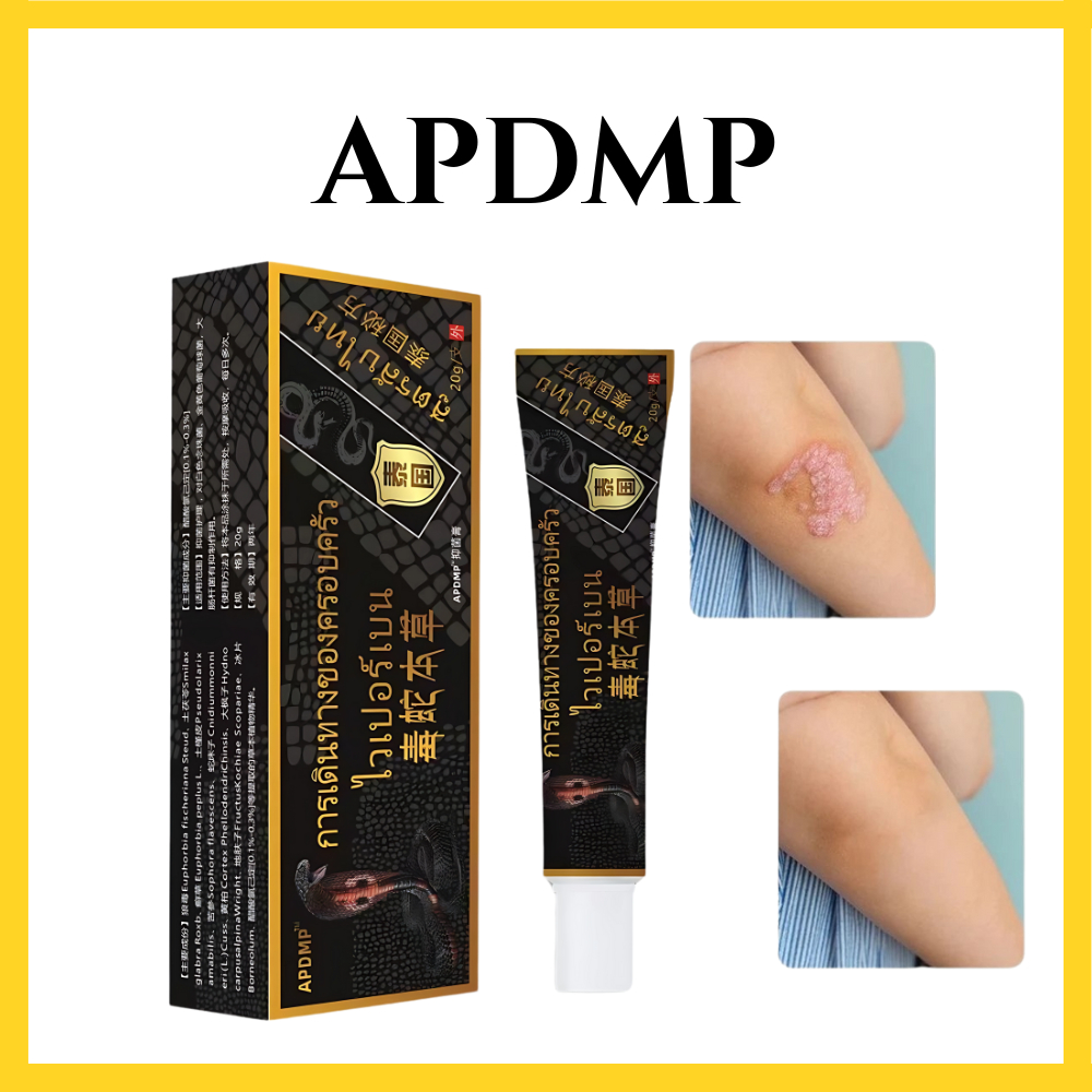 Jual Asli 100% 15Gr Salep Duwang 100% Original Psoriasis Eksim Jamur ...