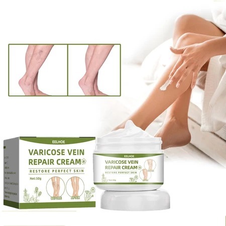 Jual EELHOE Varicose Vein Repair Cream 50gr Krim Efektif Penghilang ...