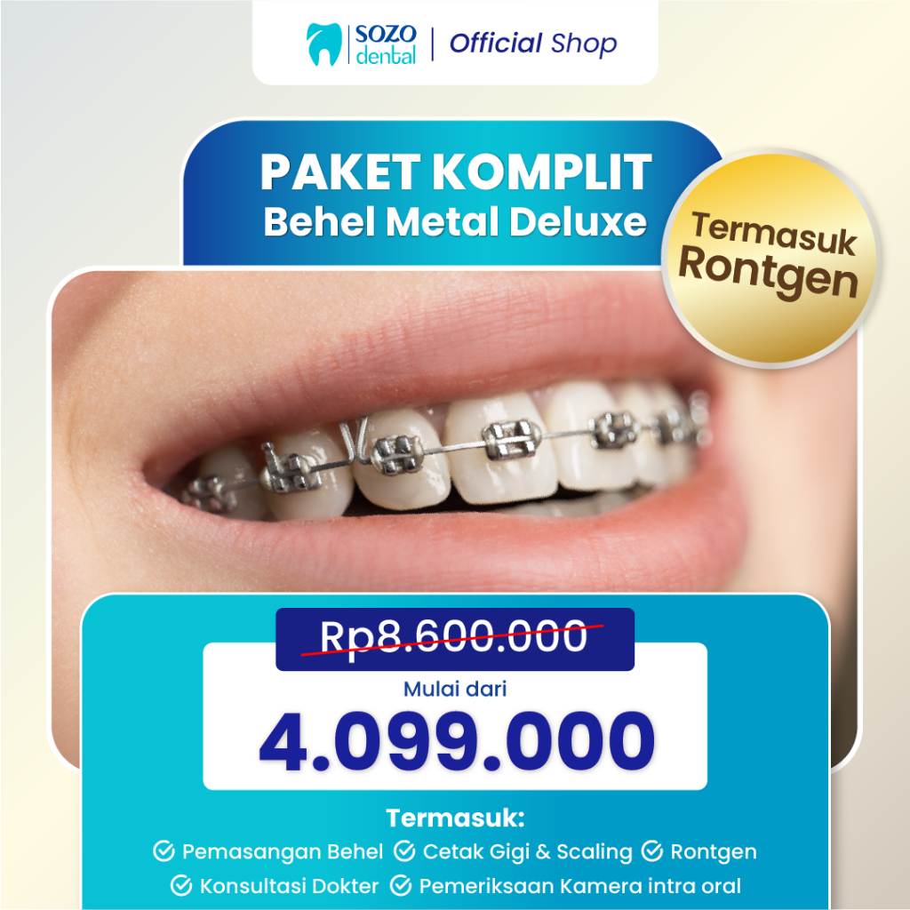 Jual Paket Behel DELUXE Komplit: Pemasangan Rahang Atas dan Bawah, Rontgen, Basic Scaling, Cetak ...