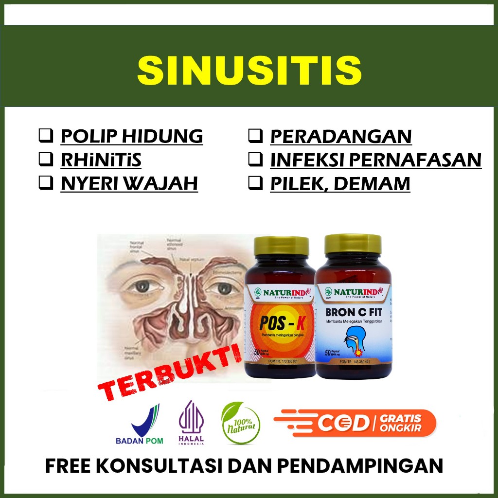 Jual Obat Sinusitis Hidung Polip Menahun Naturindo | Shopee Indonesia