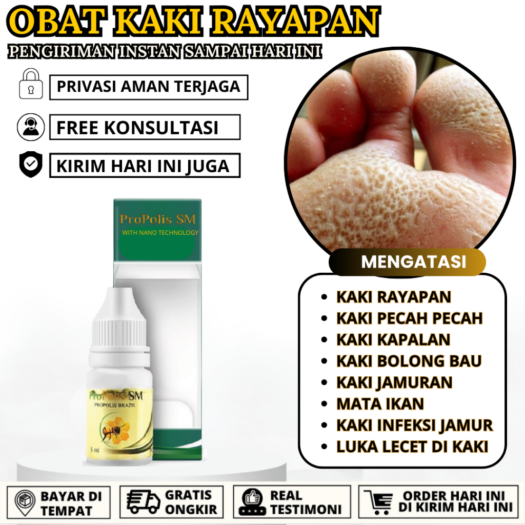 Jual Obat Herbal Kaki Rayapan Pitted Keratolysis Kaki Berlubang ...