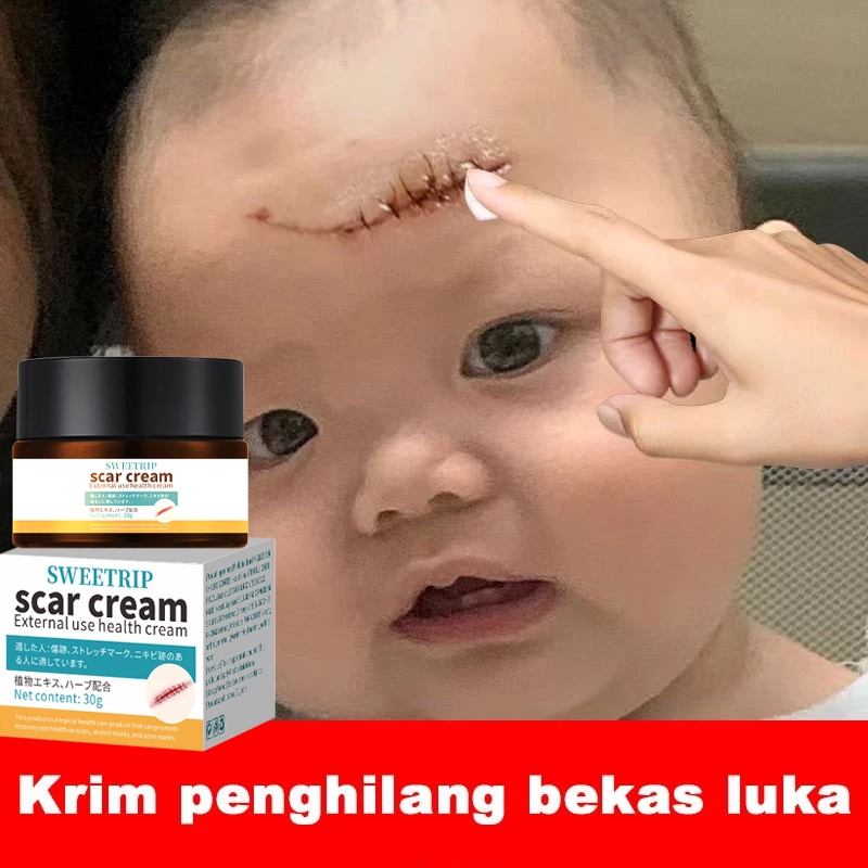 Jual SWEETRIP Obat penghilang bekas luka 30g Memudarkan Bekas Luka ...