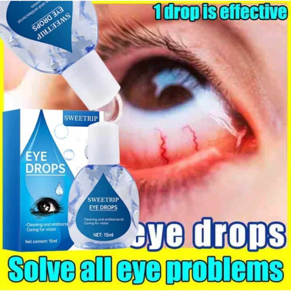 Jual SWEETRIP Eye drops Tetes eye Herbal eye Alami eye drop ...