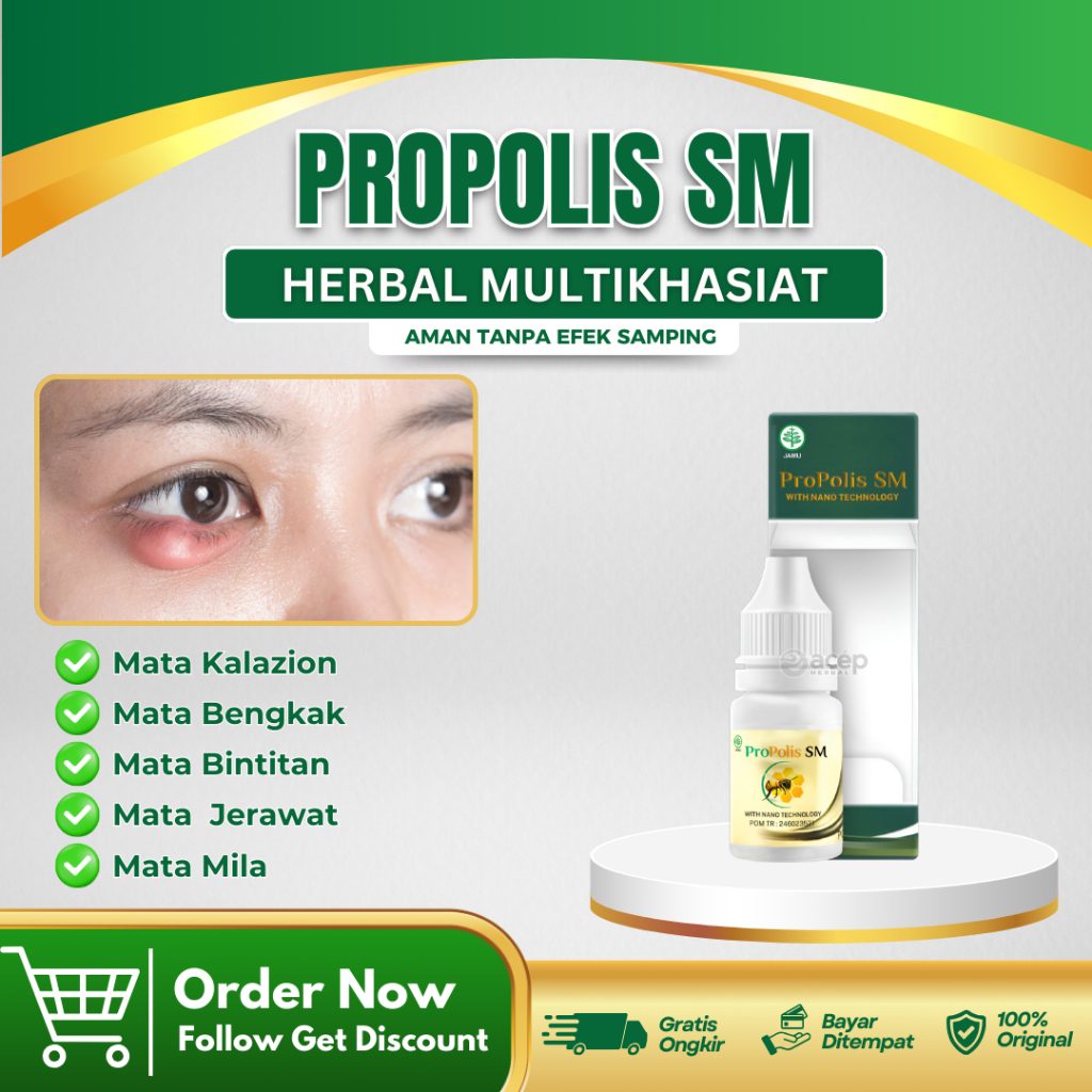 Jual Propolis SM Obat Mata Kalazion Mata Bengkak Mata Bintitan Mata ...