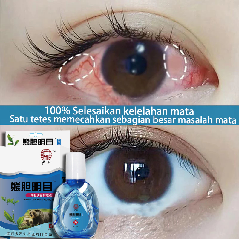 Jual Obat tetes mata obat mata minus obat mata katarak Pengobatan obat ...