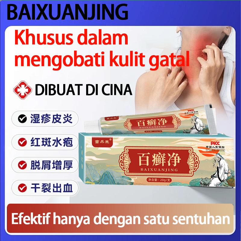 Jual Salep Antibakteri&gatal kulit 20g cepat&uh gatal / Cocok utnuk ...