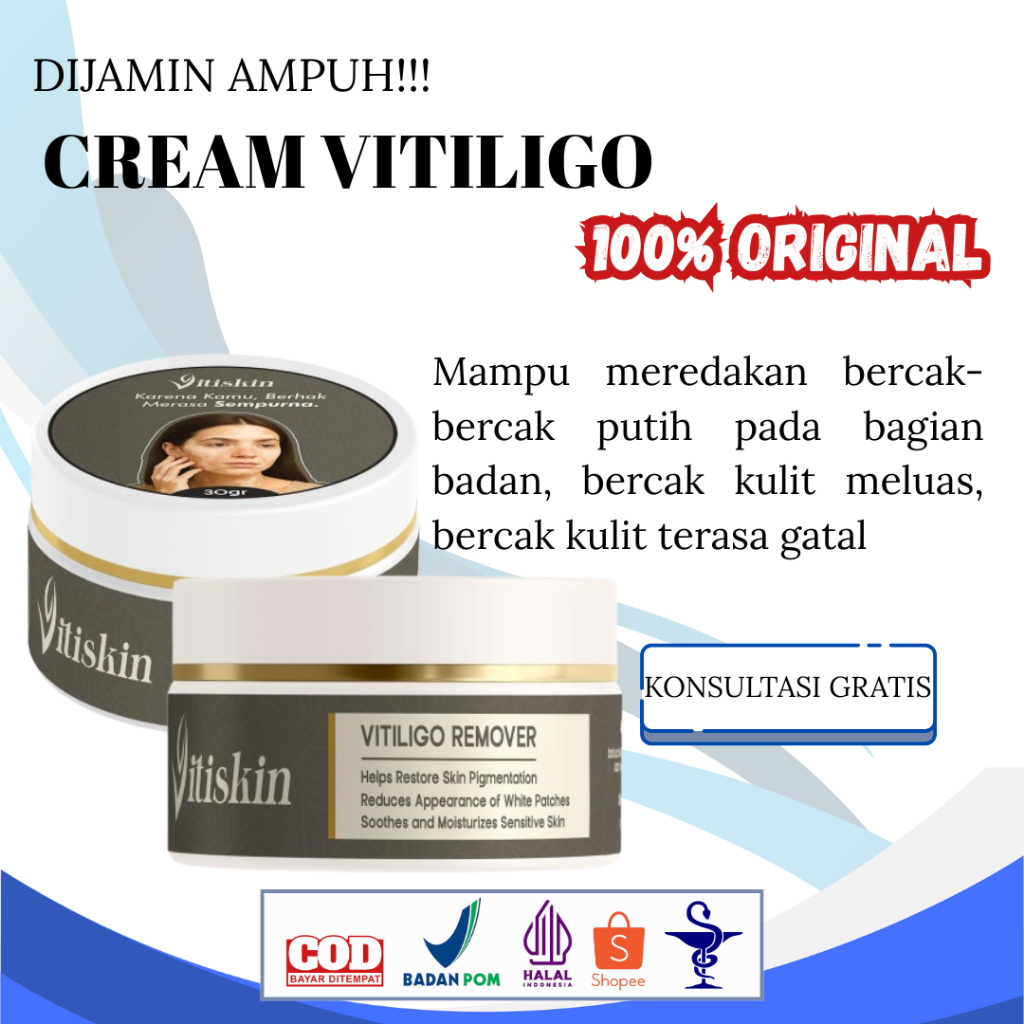Jual ORIGINAL Obat Penghilang Vitiligo Salep Cream Vitiligo Bintik ...