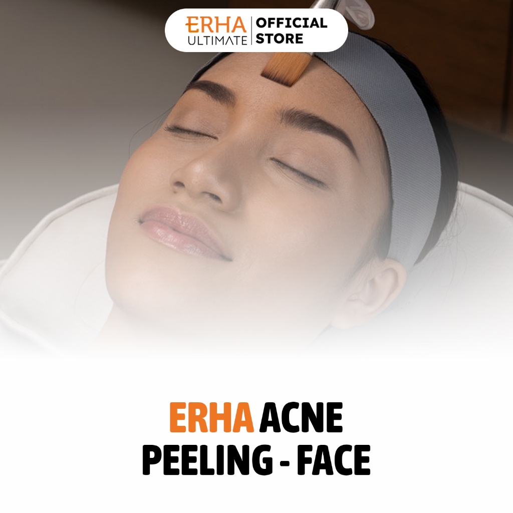 Jual ERHA Acne Peeling Face - Treatment Jerawat | Shopee Indonesia