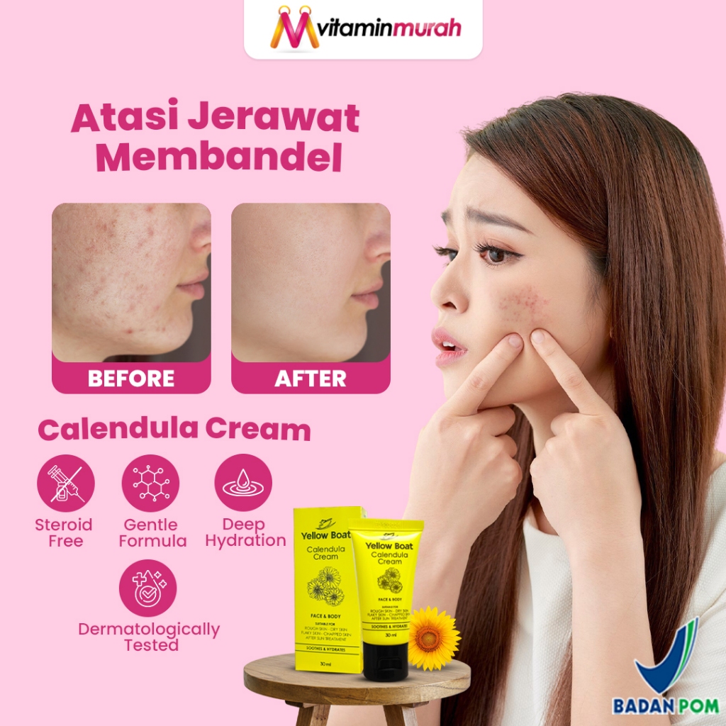 Jual Lotion untuk Kulit Berjerawat Meradang & Bekas Jerawat - Calendula Yellow Boat Calming dan ...