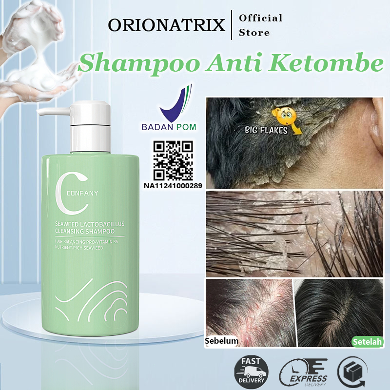 Jual Orionatrix Shampoo Anti Ketombe Dan Gatal Penghilang Ketombe Berkerak Dan Gatal Sea Salt ...
