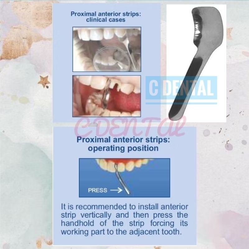 Jual [1 Piece] Dental TOR VM Anterior Proximal Metal Matrix Strip ...